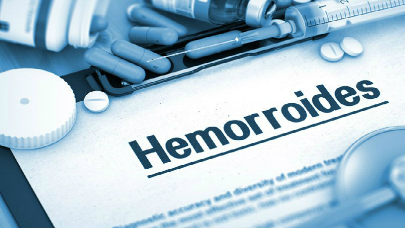 Hemorroides: causas y tratamiento | OCU