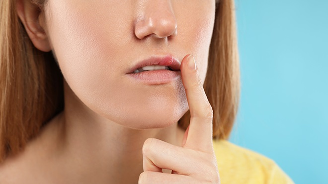 Productos para el herpes labial | OCU