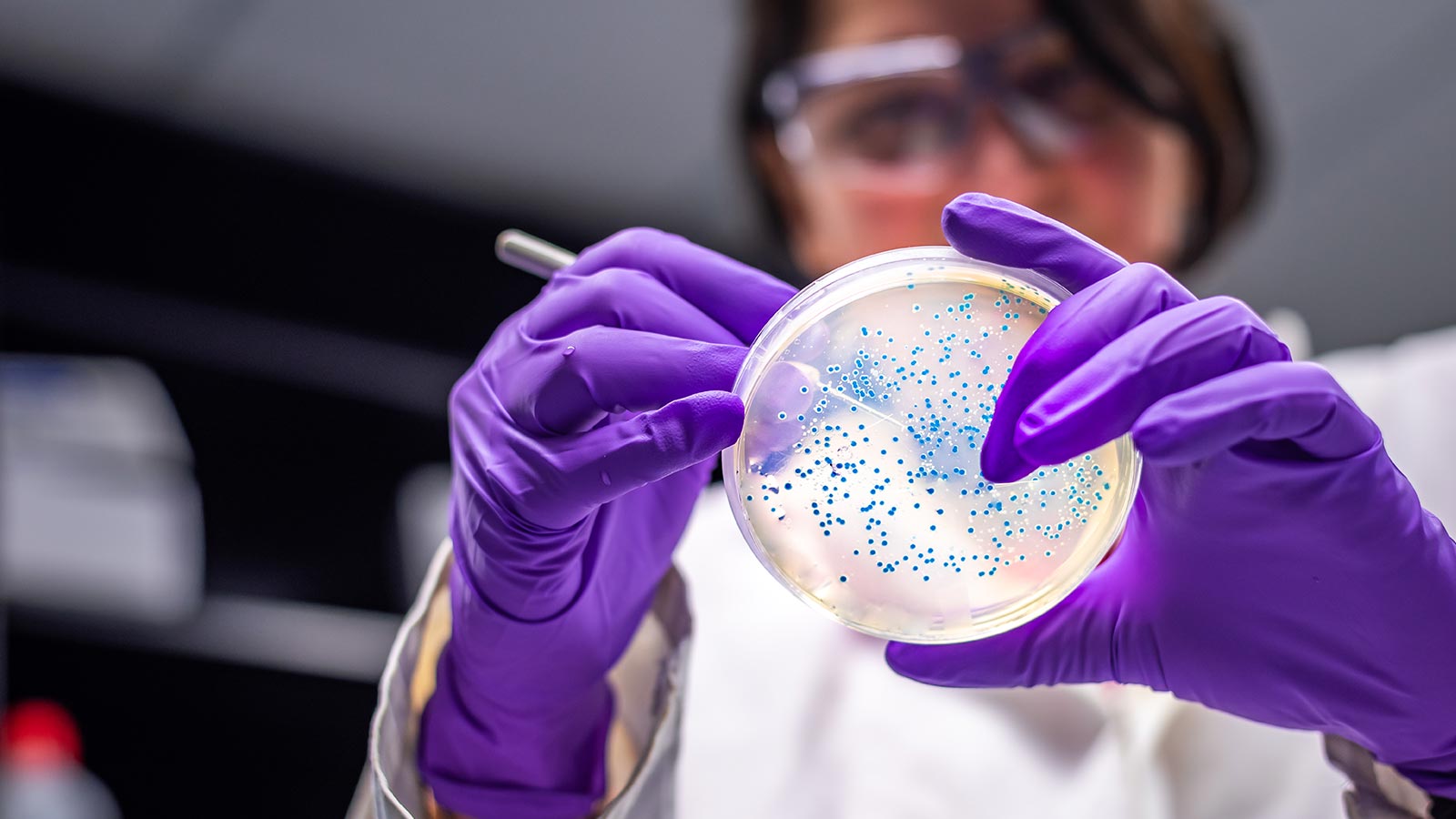 Qué son los bacteriófagos | OCU